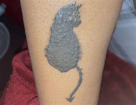 7 Month Healed Tattoo Is Slightly Raised And Has All These Bumps On It