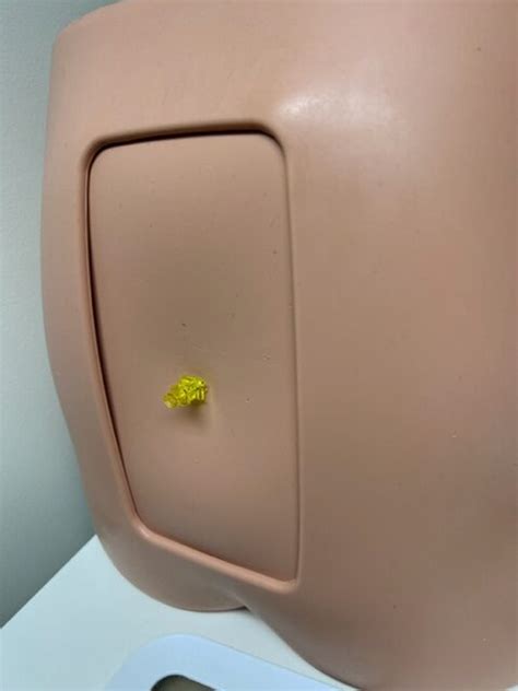 Performing Spinal Anaesthesia For Caesarean Sections The Anaesthesia Collective