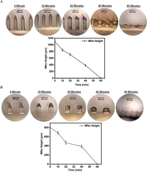 Hyperhidrosis Treatment New Research R Hyperhidrosis