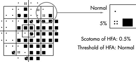 An Example Of Evaluating A Cluster Of Hfa Threshold Of Hfa Means The
