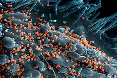 More People Are At Risk From Deadly Lassa Fever Than We Thought