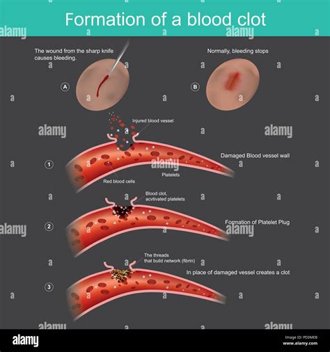 Capillary Bleeding