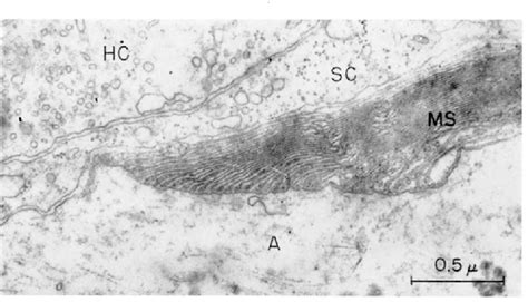 Utricular Macula Semantic Scholar
