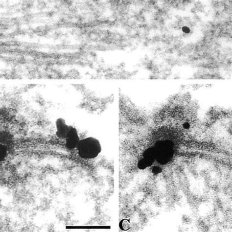 Localization Of Gfp Spc29p By Immunoem In Log Phase Cells A Short