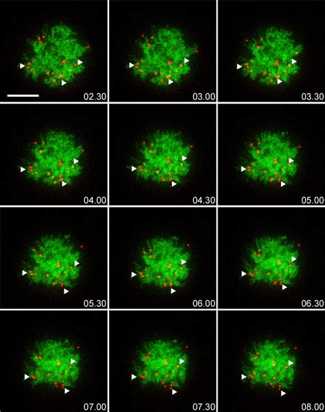 Pml Nb Dynamics Upon Calyculin A Induced Premature Chromosome Download Scientific Diagram