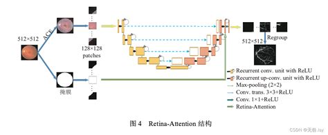 基于 Retina Gan 的视网膜图像血管分割眼底视网膜分割 图像分割 Csdn博客