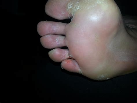 Alex Nicholss Feet
