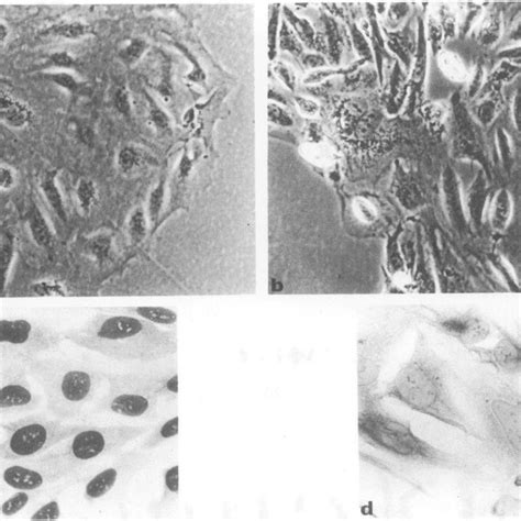 Appearance Of Monolayers Of Normal Primary Human Thyroid Epithelium A