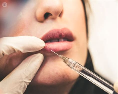 Botox Benefits Risks And Results
