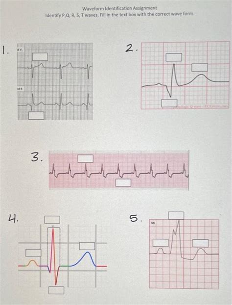 Solved Waveform Identification Assignment Identify P Q R