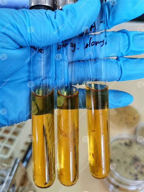 Tryptone Soya Broth Stock Image Image Of Glass Food 299766973