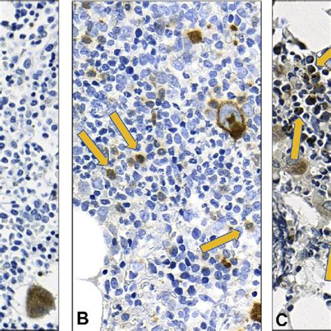Types And Distribution Of Calr Mutations And Negative Controls Included Download Scientific