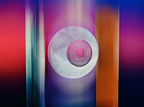 How Bionic Eyes Can Restore Vision And Help Blind People See Washington Post