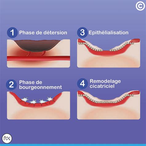 Quels Sont Les Différents Types Dablation Par Voie Endoscopique Vyqvxn