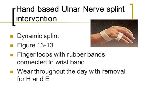 Splinting For Peripheral Nerve Injuries Ppt Video Online Download