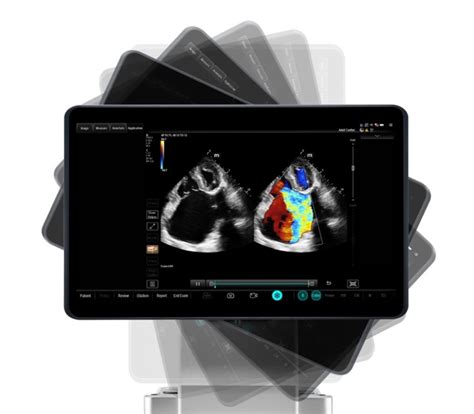 Michelle Carter On Linkedin Mindray Te X Ultrasound System Redefining