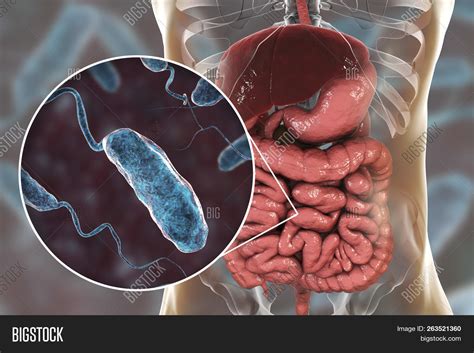 Vibrio Cholerae Image And Photo Free Trial Bigstock