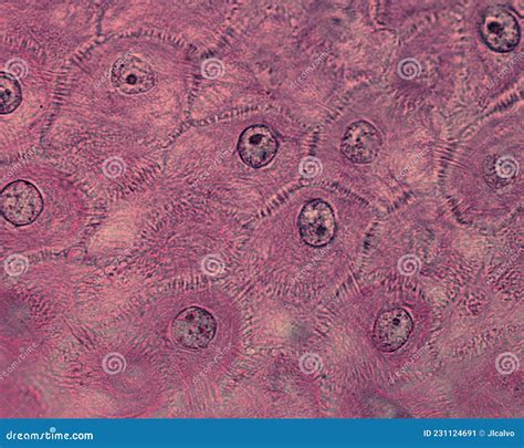 Epidermis Spinous Cell Layer Stock Image Image Of Histology