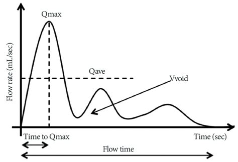 Uroflow And Residual Urine Springerlink 42 Off