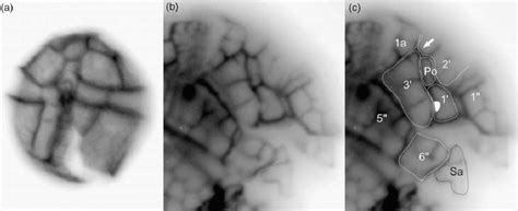 Fluorescence Microscopy Of Calcofluor Stained Material Of Strain Gg1am