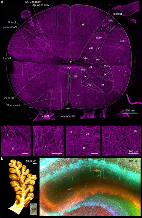Application Of 3d Immunohistochemistry With Next Generation Histology Download Scientific