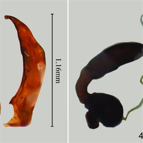 Differences Between Epitrix Papa Sp N From Portugal And E Similaris