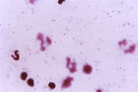 The 1 Solution Decoding Malaria Genomes Broad Institute