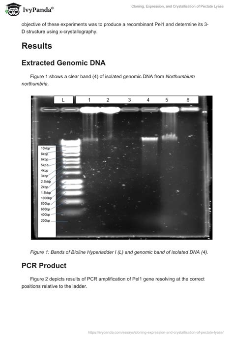 Cloning Expression And Crystallisation Of Pectate Lyase 917 Words Essay Example