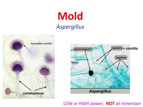 Aspergillus Slide Labeled