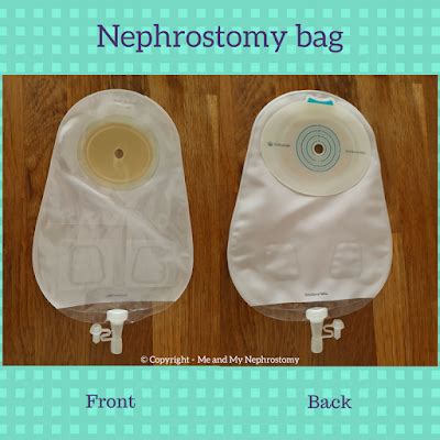So What Is A Nephrostomy