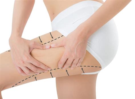 Thigh Lift Surgyteam