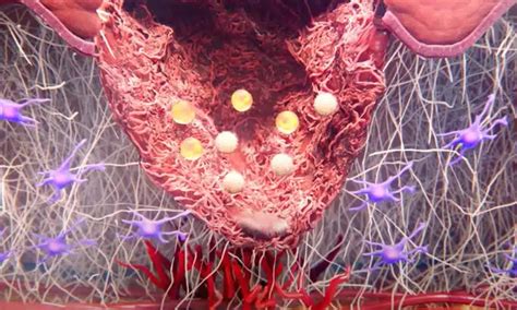 Two2 Extremity Chamber Advanced Oxygen Therapy Inc