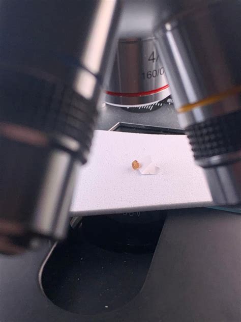 Jumping Spider Head Cap Through My Microscope R Spiderbro