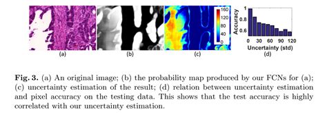 2017 Miccai Suggestive Annotation A Deep Active Learning Framework