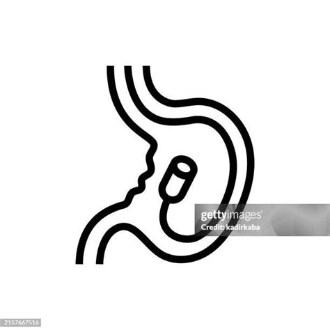 59 Colonoscopy Vector High Res Illustrations Getty Images