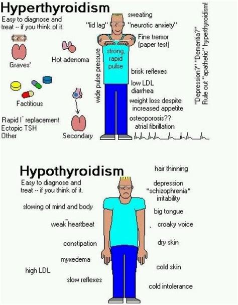 Hyperthyroidism Vs Hypothyroidism Chart