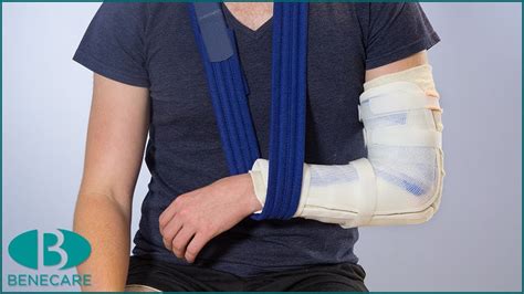 Elbow Dislocation Splint At Cecila Whitworth Blog