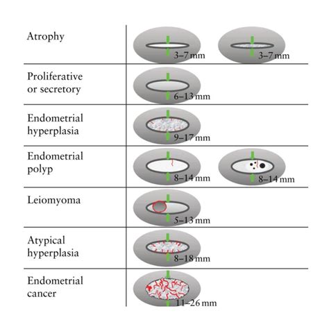 Isuog International Society Of Ultrasound In Obstetrics And Gynecology On Linkedin Ultrasound
