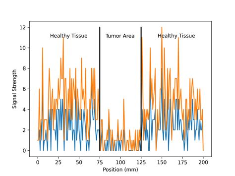 Improving Tumor Detection In X Ray Images Using Monte Carlo Simulation Based Optimization Nhsjs