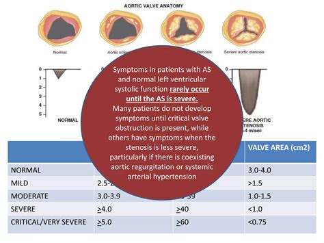 Natural History And Treatment Of Aortic Stenosis Pptx