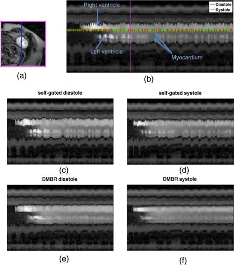 Example Of Deformable Registration Process A Indication Of The Download Scientific Diagram