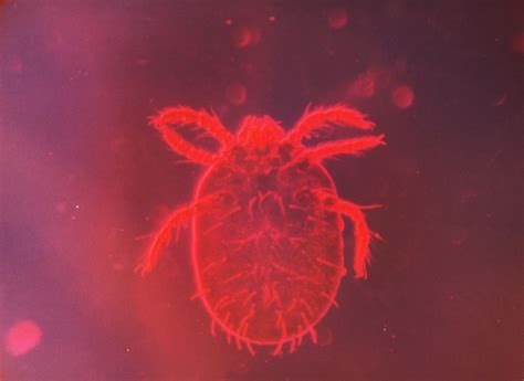 What Are Chigger Bites And How Can You Stop The Itch