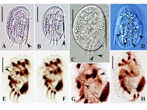Media Gallery Marine Benthic Ciliates