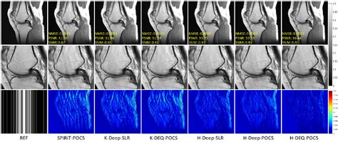 Figure 1 From Equilibrated Zeroth Order Unrolled Deep Network For Parallel Mr Imaging Semantic