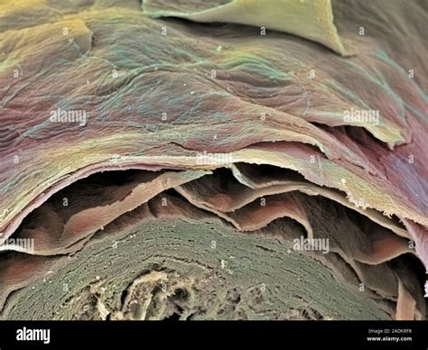 Skin Layers Coloured Scanning Electron Micrograph Sem Of A Freeze Fractured Section Through