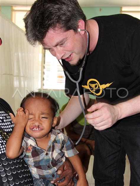 Periksa Pasien Bibir Sumbing Antara Foto