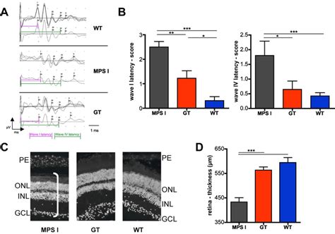 Effect Of Gene Therapy On Auditory Brainstem Responses And Retina Download Scientific Diagram
