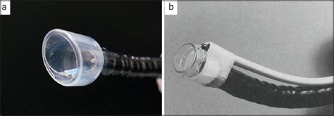 Cap And Band Endoscopic Mucosal Resection Abdominal Key