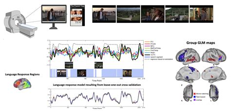Presurgical Language Mapping With Movie Watching Naturalistic Fmri