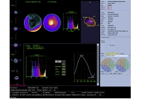 B The Gated Spect Study Of The Patient With Anterior St Elevation